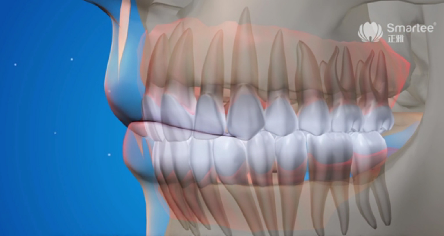 Tecnología Smartee - Smartee Colombia