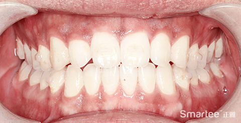 Casos reales - Smartee Colombia