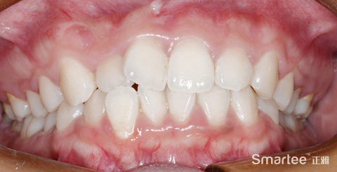 Casos reales - Smartee Colombia