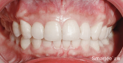 Casos reales - Smartee Colombia